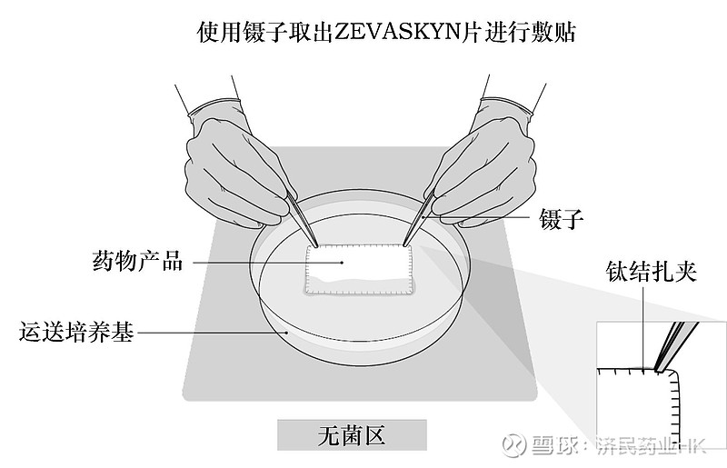 大疱性表皮松解症第三种疗法！FDA批准ZEVASKYN基因改进细胞薄片 Abeona Therapeutics Inc.于4月29日宣布，美国 ...