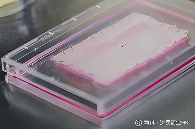 大疱性表皮松解症第三种疗法！FDA批准ZEVASKYN基因改进细胞薄片 Abeona Therapeutics Inc.于4月29日宣布，美国 ...